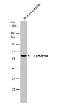 Coagulation Factor VII Antibody (NBP1-31421): Novus Biologicals
