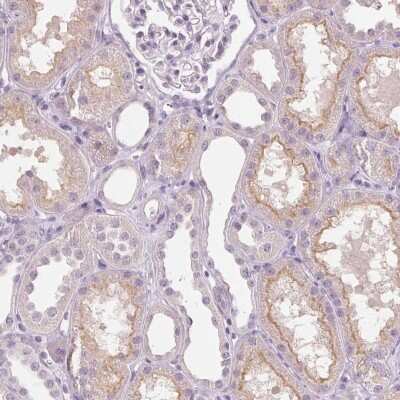 Collectrin/TMEM27 Antibody (NBP2-13450): Novus Biologicals