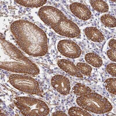 Cortactin Antibody (NBP2-38826): Novus Biologicals