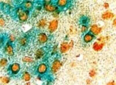 Cre Antibody - BSA Free (NB100-56133): Novus Biologicals