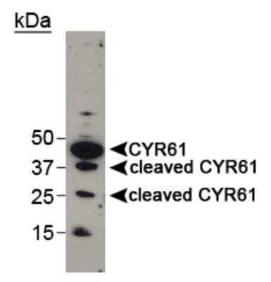 Cyr61/CCN1 Antibody (NB100-357): Novus Biologicals