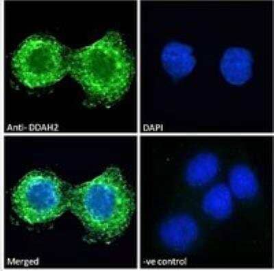 DDAH2 Antibodies: Novus Biologicals