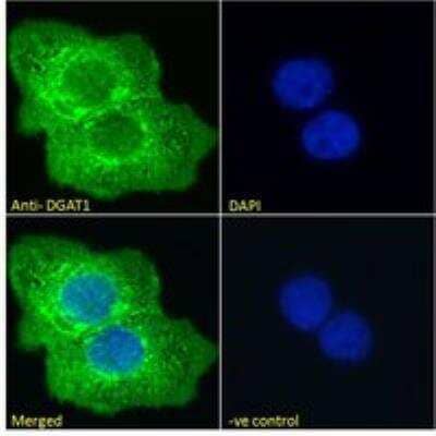 DGAT1 Antibody (NB100-57086): Novus Biologicals