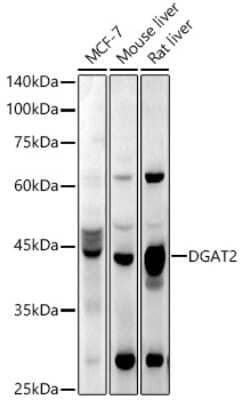 DGAT2 Antibody (NBP2-92727): Novus Biologicals