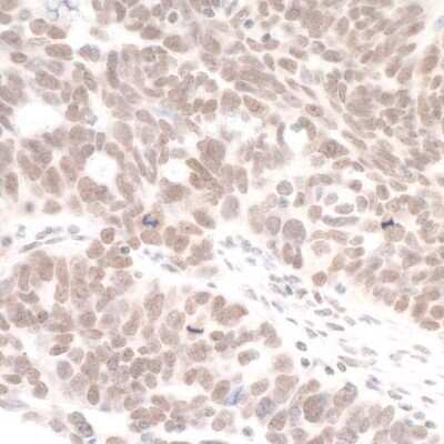 DHX8 Antibody (NB100-1713): Novus Biologicals