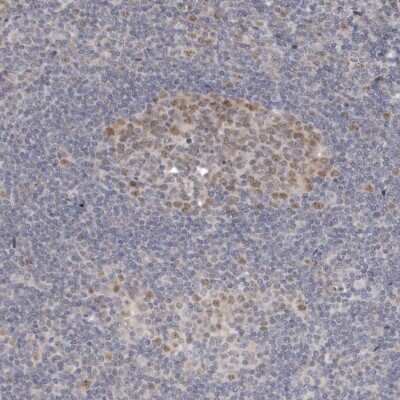 DNA Polymerase epsilon p59 Antibody (NBP1-87970): Novus Biologicals