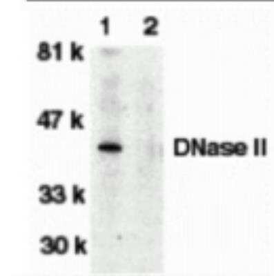 DNase II Antibodies: Novus Biologicals