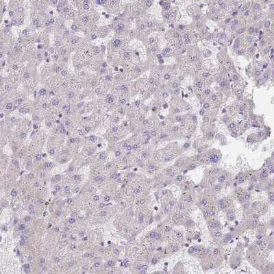 DONSON Antibody (NBP2-38599): Novus Biologicals