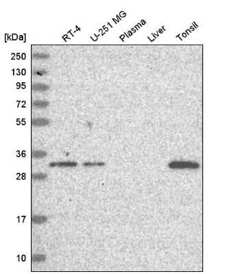 DONSON Antibody (NBP2-13931): Novus Biologicals