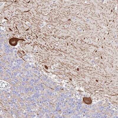 Dynorphin Antibody (NBP2-48948): Novus Biologicals