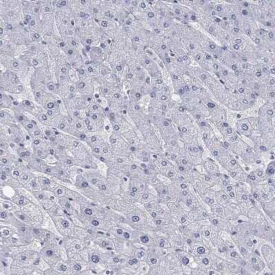 Prodynorphin/PDYN Antibody (NBP2-49081): Novus Biologicals