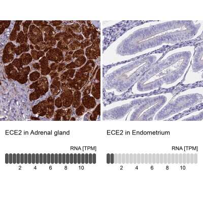 ECE-2 Antibody (NBP1-81495): Novus Biologicals