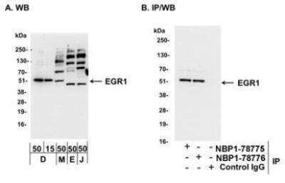 EGR1 Antibody (NBP1-78775): Novus Biologicals