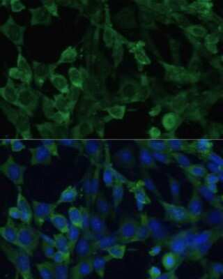 EIF1A Antibody (NBP2-92896): Novus Biologicals