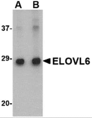 ELOVL5 Antibody (NBP2-33500): Novus Biologicals