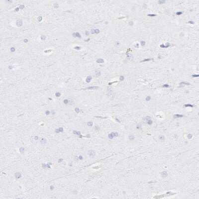 EN-RAGE/S100A12 Antibody (NBP1-86694): Novus Biologicals