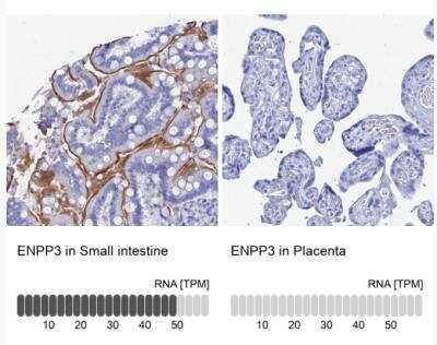 ENPP-3/CD203c Antibody (NBP1-88928): Novus Biologicals