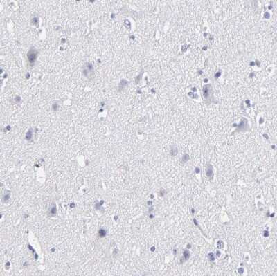 FABP4/A-FABP Antibody (NBP1-89218): Novus Biologicals