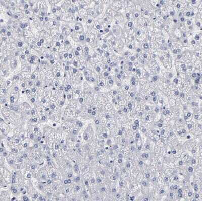 FABP4/A-FABP Antibody (NBP1-89218): Novus Biologicals