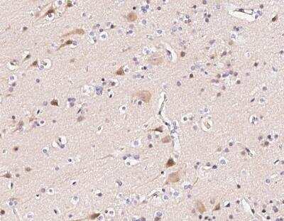 FANCC Antibody (NBP3-12777): Novus Biologicals