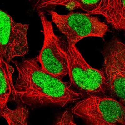 FKBP51/FKBP5 Antibody (NBP1-84676): Novus Biologicals