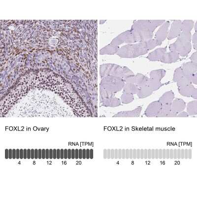 FOXL2 Antibodies: Novus Biologicals