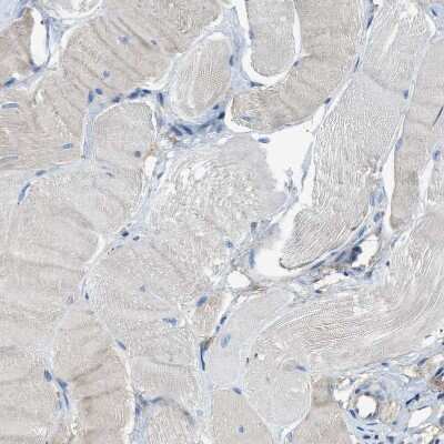 FPRP/PTGFRN Antibody (NBP1-85762): Novus Biologicals