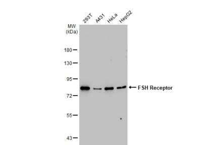 FSHR Antibody (NBP2-16537): Novus Biologicals