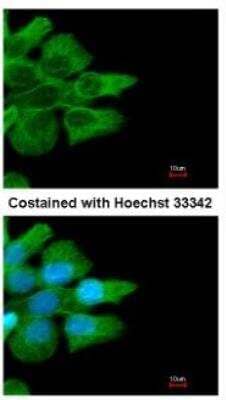 Fc gamma RIIB/CD32b Antibody (NBP2-14905): Novus Biologicals