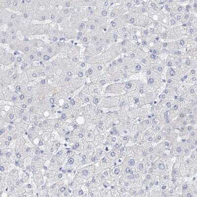 Filaggrin Antibody (NBP1-87527): Novus Biologicals