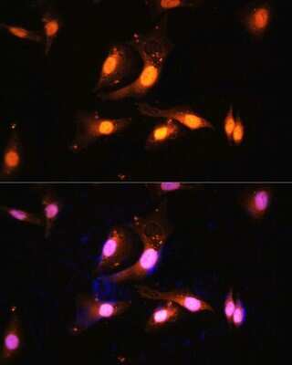 Folliculin Antibody - Azide and BSA Free (NBP3-03257): Novus Biologicals