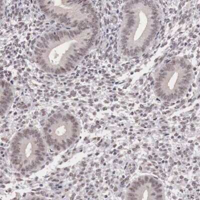 FoxP2 Antibody (NBP1-86672): Novus Biologicals