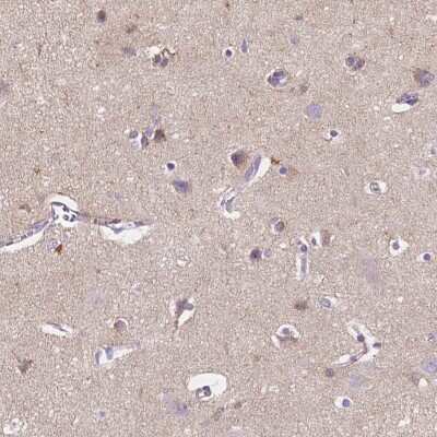 GABA-A R delta Antibody (NBP2-33421): Novus Biologicals