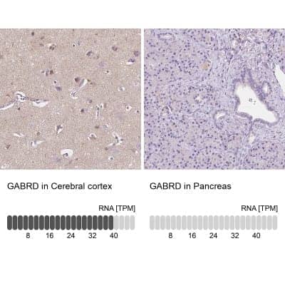 GABA-A R delta Antibody (NBP2-33421): Novus Biologicals