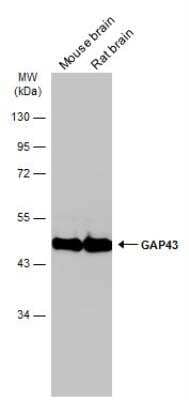 GAP-43 Antibodies: Novus Biologicals