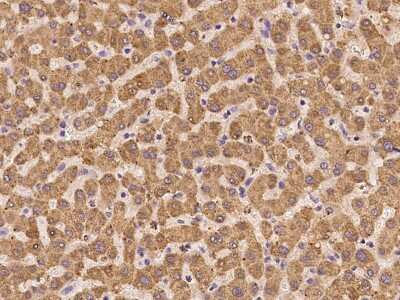 GGCX Antibody (NBP2-98509): Novus Biologicals