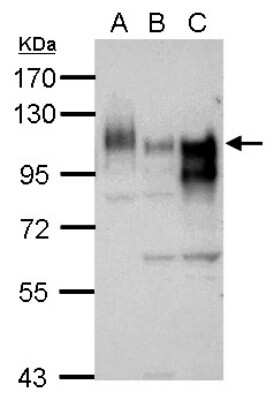 GGCX Antibody (NBP2-16651): Novus Biologicals