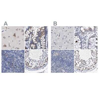 GM130/GOLGA2 Antibody (NBP1-89757): Novus Biologicals
