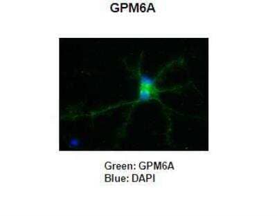 GPM6A Research Products: Novus Biologicals