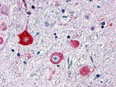 GPR151 Antibody (NLS415): Novus Biologicals