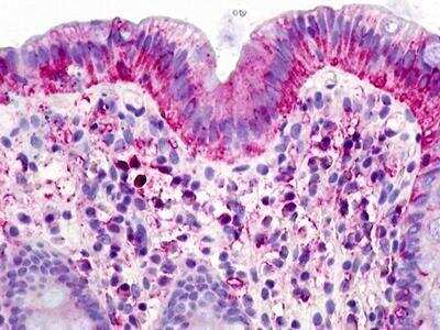 GPR160 Antibody (NLS619): Novus Biologicals