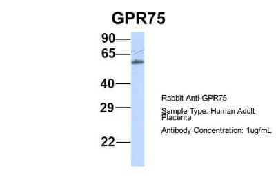 GPR75 Antibodies: Novus Biologicals