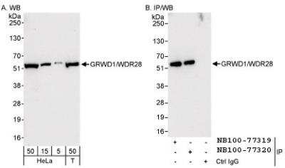 GRWD1 Antibody (NB100-77319): Novus Biologicals