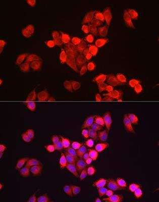 Galactosylceramidase/GALC Antibody (NBP3-03718): Novus Biologicals