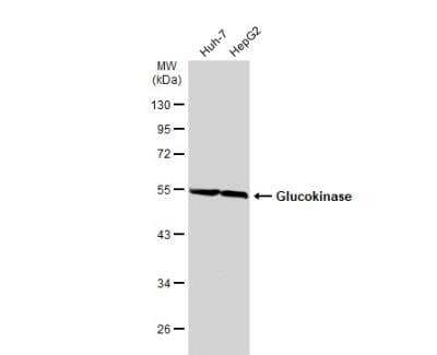 Glucokinase/GCK Antibody (NBP1-33144): Novus Biologicals