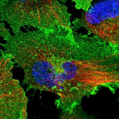 Glut1 Antibodies: Novus Biologicals