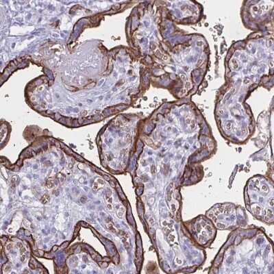 Glut1 Antibody (NBP2-54745): Novus Biologicals