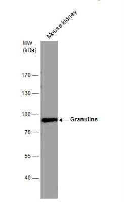 Granulin Antibodies: Novus Biologicals