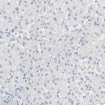 Granzyme B Antibody (NBP1-88151): Novus Biologicals