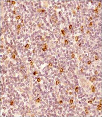 Granzyme B Antibodies: Novus Biologicals